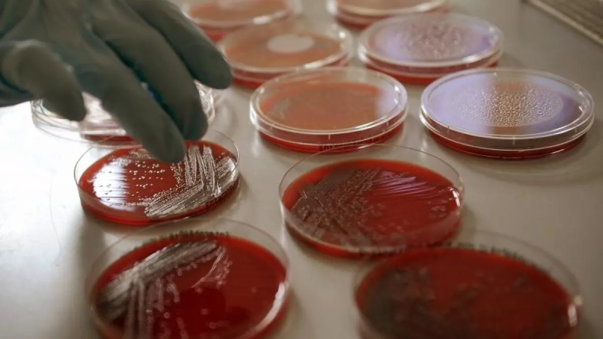 Klice povrća izvor epidemije Escherichije coli - Net.hr