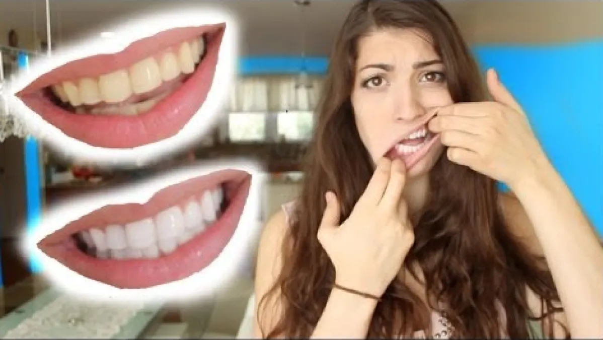 5 TRENDI METODA IZBJELJIVANJA ZUBA NA TESTU: Loše vijesti za one koji ...