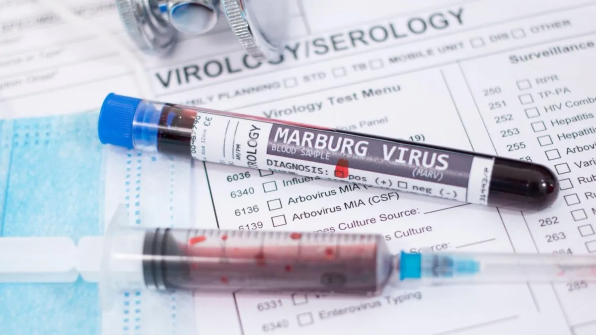 Ovo su simptomi Marburg virusa koji se pojavio u Njemačkoj - Net.hr