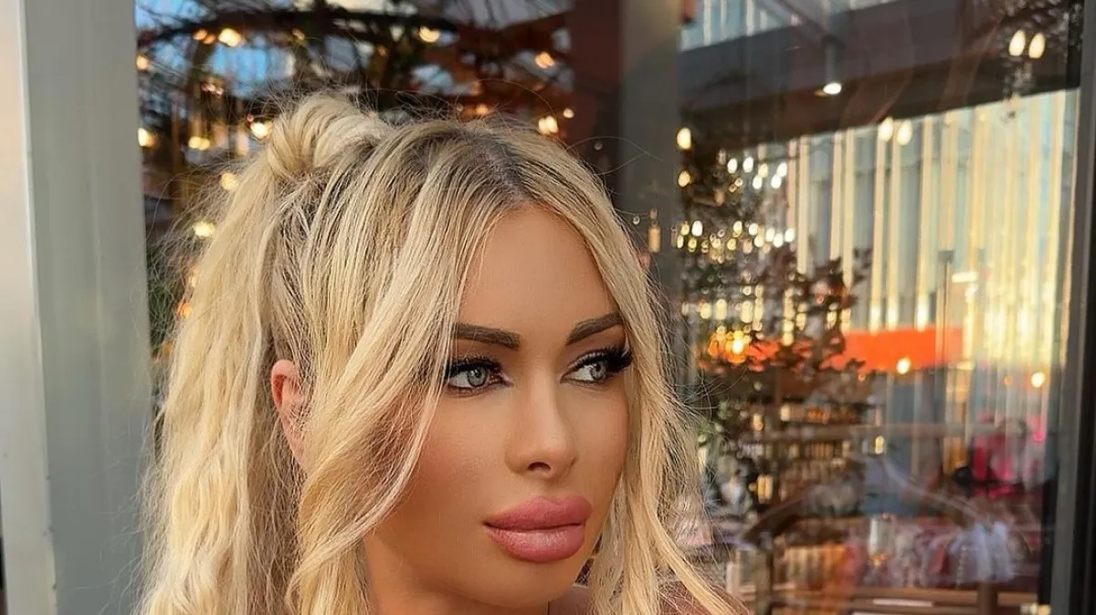 Milica Polskaya o samopouzdanju i estetskim korekcijama. 'S usnama ...